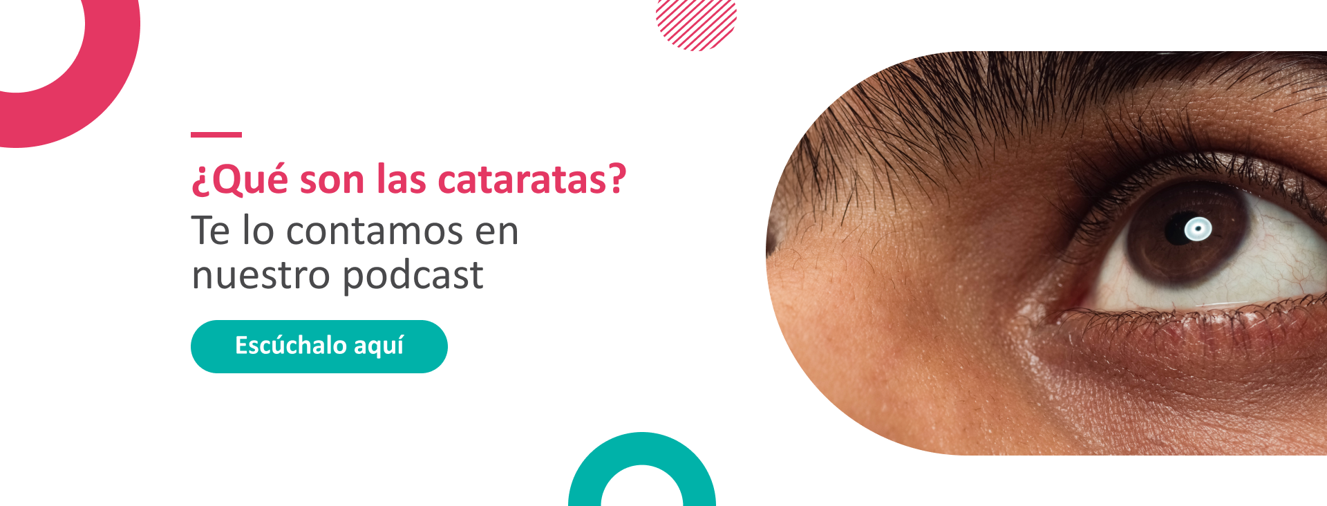 ¿Cuánto vale una cirugía de cataratas en Colombia? Todo lo que debes saber